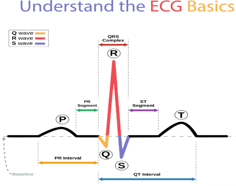 Interpreting ST Elevations On An ECG (electrocardiogram)- 2024