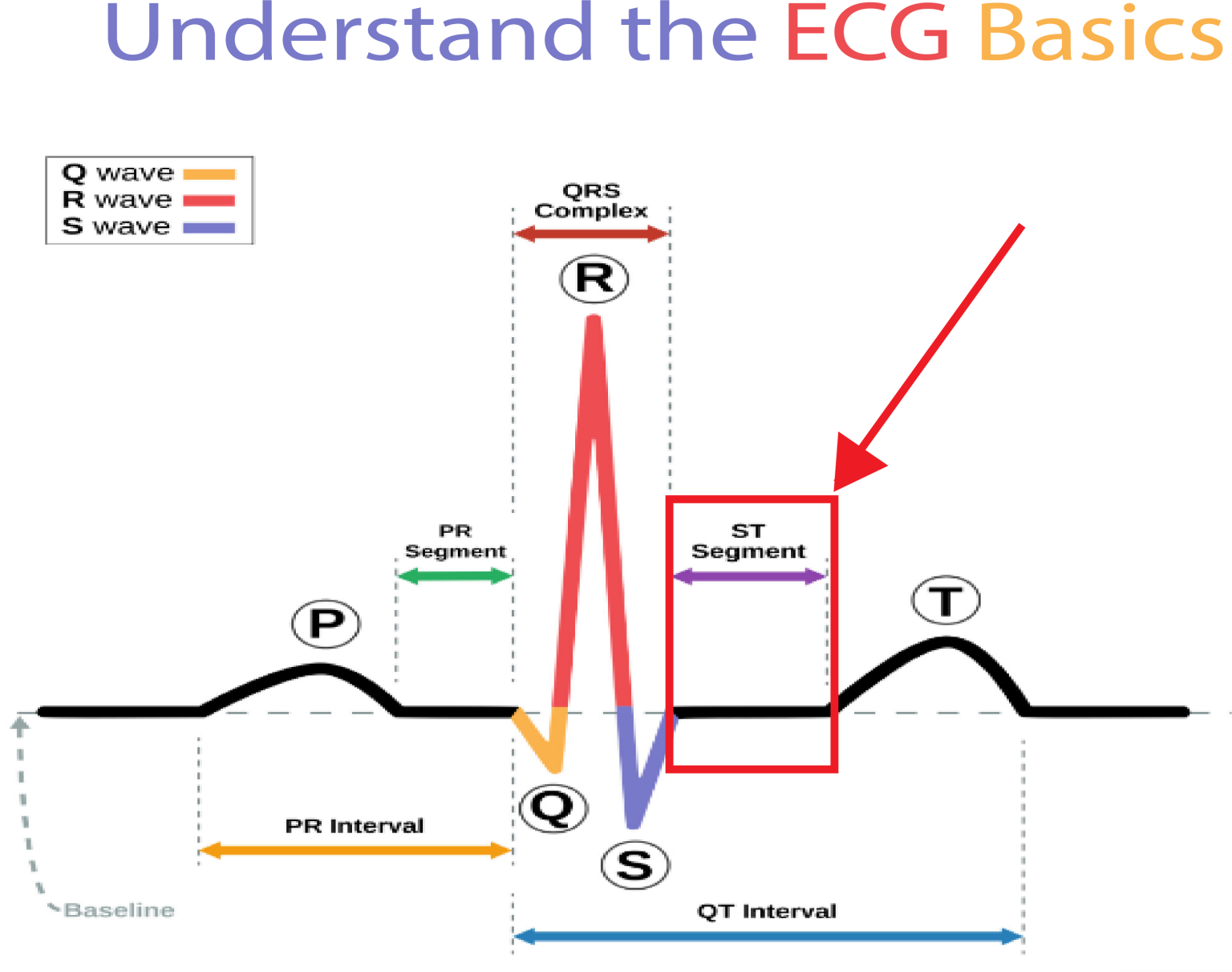 Interpreting ST Elevations On An ECG (electrocardiogram)- 2024